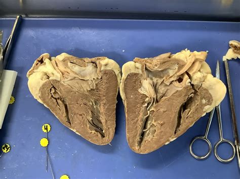 Image result for Human Heart Dissection