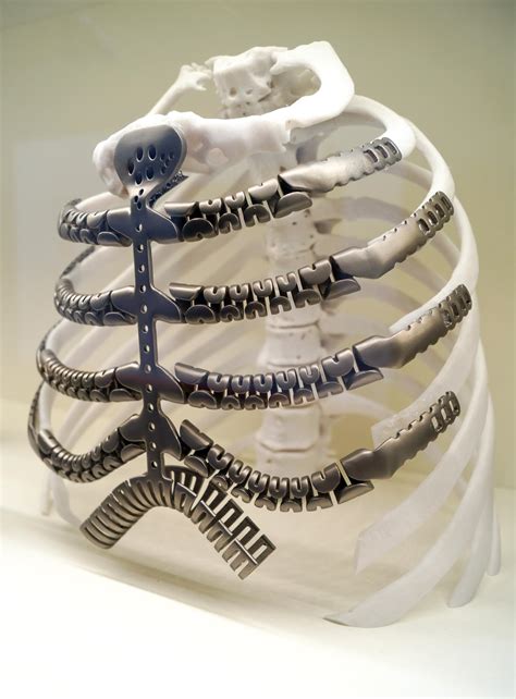 Image result for Metal Additive