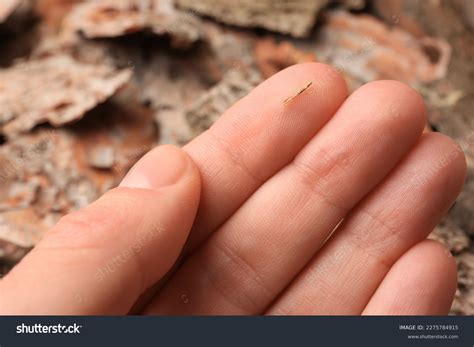 Image result for Splinter Finger