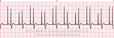 Image result for ECG Reading Practice