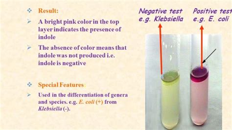 Image result for Indole Test Procedure