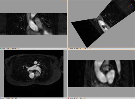 Image result for Seg3d Tutorial