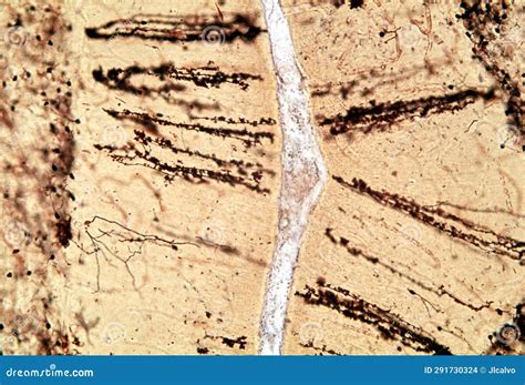 Image result for Cell Cortex