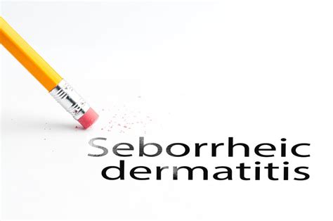 Image result for Seborrheic Dermatitis Contagious
