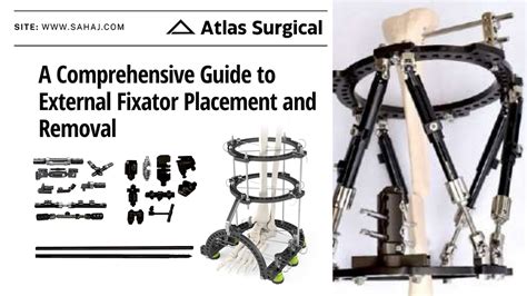 Image result for External Fixator Surgery