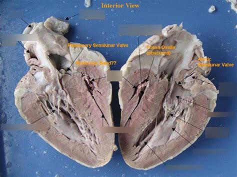 Image result for Heart Dissection