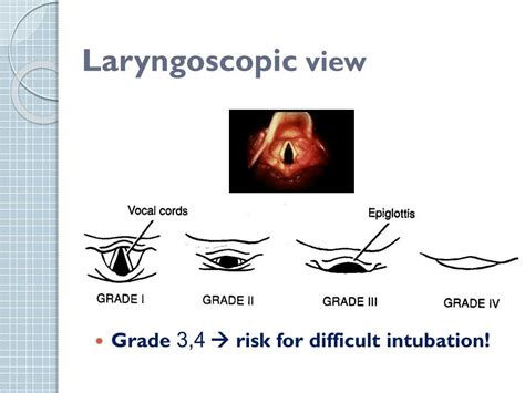 Image result for Intubation Steps