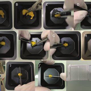 Image result for Mouse Brain Dissection