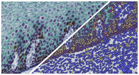 Image result for Multiplex IHC Texture Types Diffuse