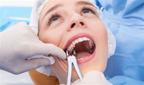 Image result for Wisdom Tooth Extraction Surgery Procedure