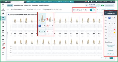 Image result for How to Perio Chart