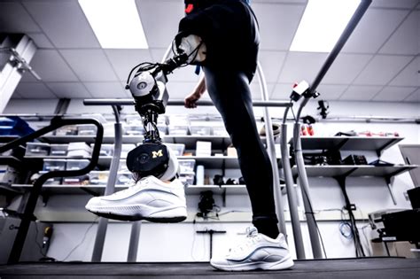 Image result for Raspberry Pi Prosthetic