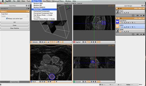 Image result for Seg3d Tutorial