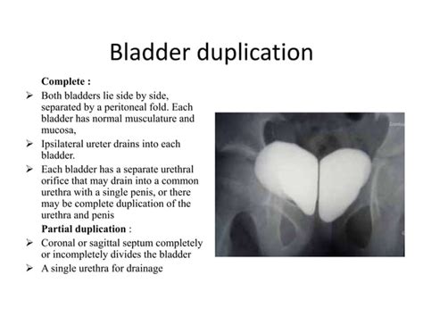 Image result for Rgu Retrograde Urethrogram