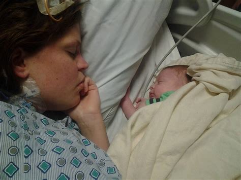 Image result for AVM Recovery