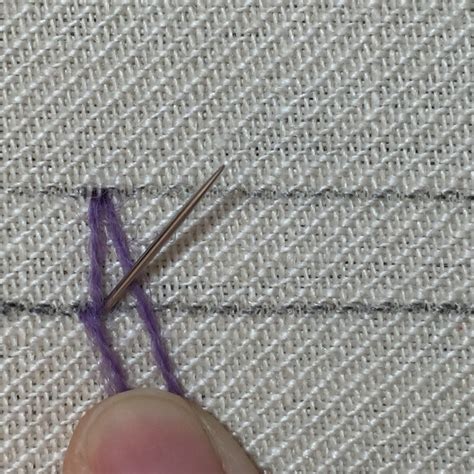 Image result for Buttonhole Invagination