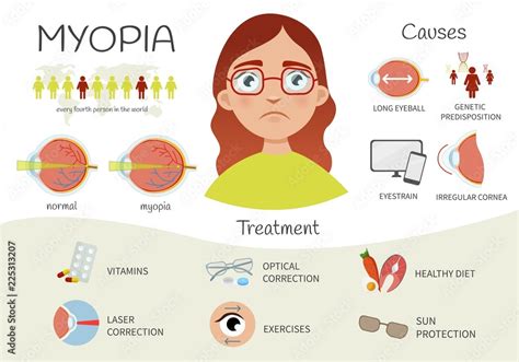 Image result for Vision Defects Myopia