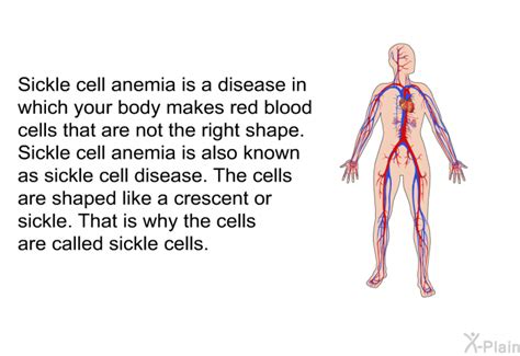 Image result for Sickle Cell Anemia Explained