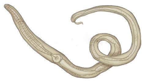 Image result for What Is Pinworm