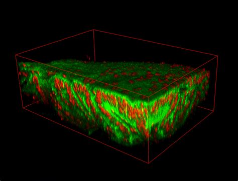 Image result for Discus Block Leg