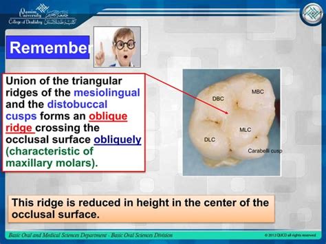 Image result for Maxillary First Molar