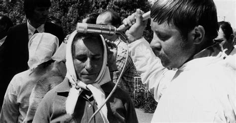 Image result for Chernobyl Disaster Human Body