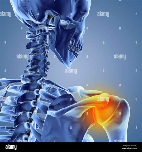 Image result for Shoulder Pain Computer