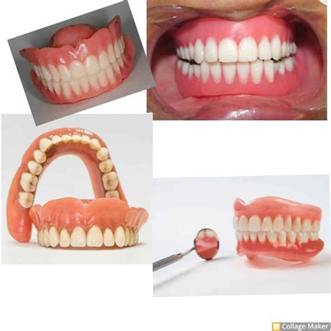 Image result for Denture Types