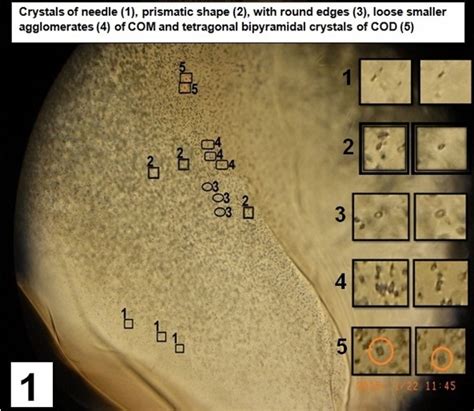 Image result for Microscope Crystal Compemnsator
