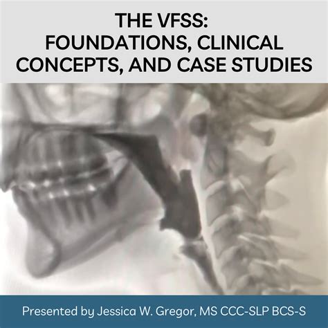 Image result for VFSS Procedure