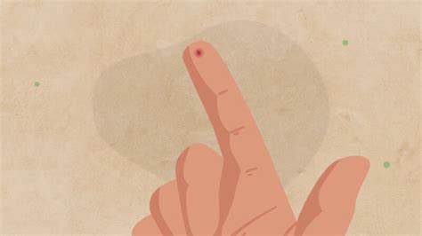 Image result for Deep Splinter Removal