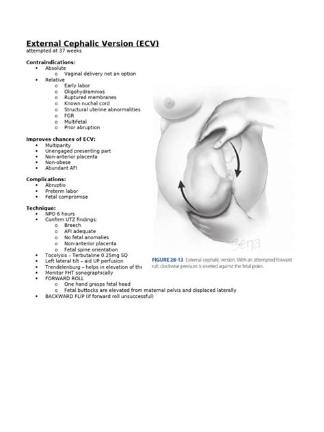 Image result for External Cephalic Version Step by Step