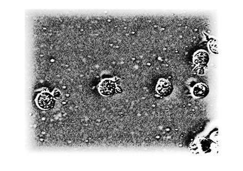 Image result for Homomorphic filtering Applications