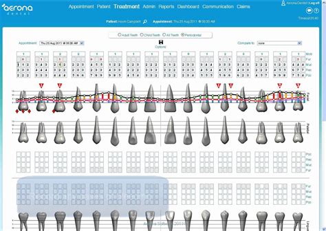 Image result for How to Read a Perio Chart