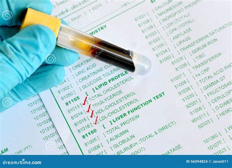 Image result for Lipid Profile Testing