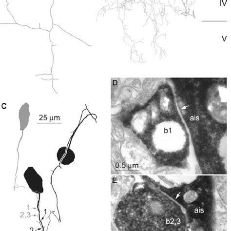 Image result for Axonic AmFirst