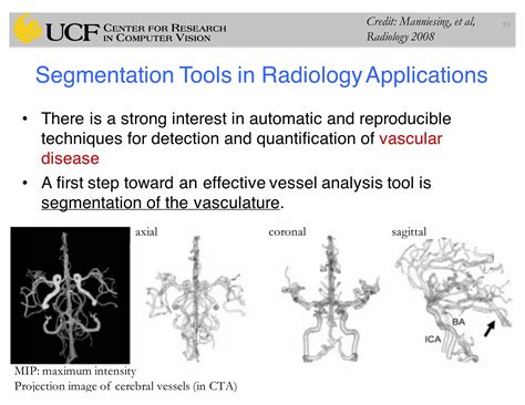 Image result for Image Segmentation Applications