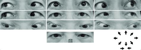 Image result for Eye Movements Test