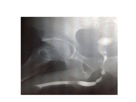 Image result for Urethrogram Procedure