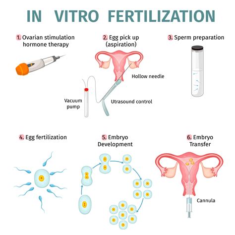 Image result for In Vitro Fertilization Procedure Step by Step