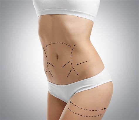 Image result for Body Contouring Surgery