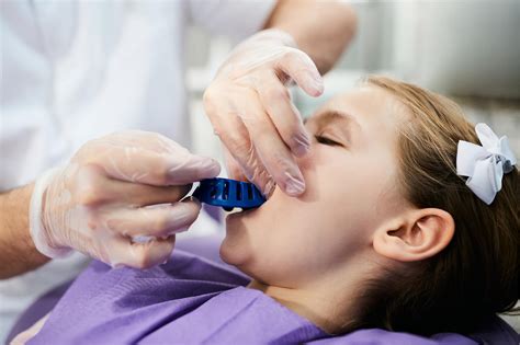 Image result for Impression Procedure