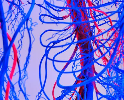 Image result for Different Types of Angiogram