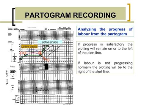 Image result for Partogram Design