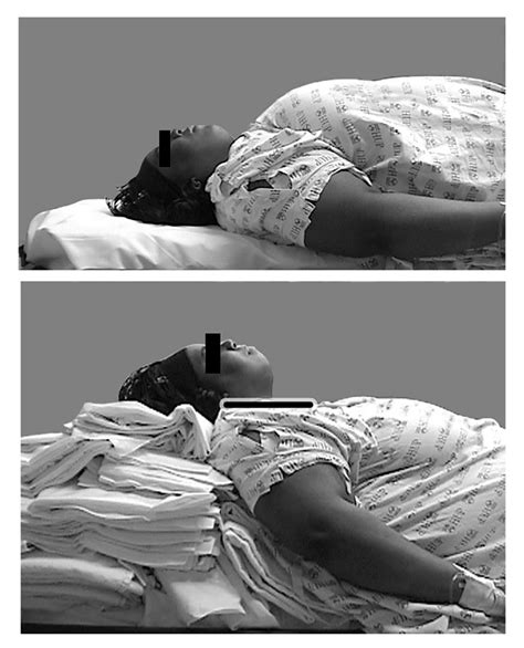 Image result for Intubation Position