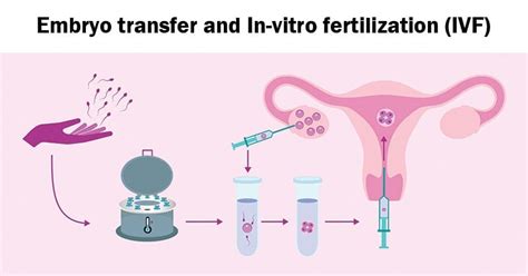 Image result for Watch Embryo Transfer