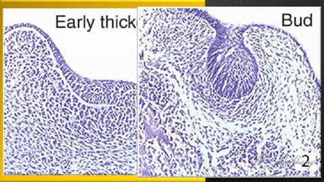 Image result for Tooth Development Video