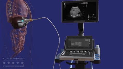 Image result for C4D Medical Modeling