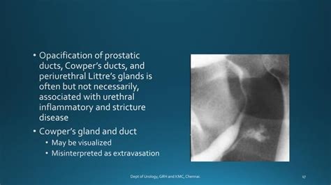 Image result for Acending Urethrogram