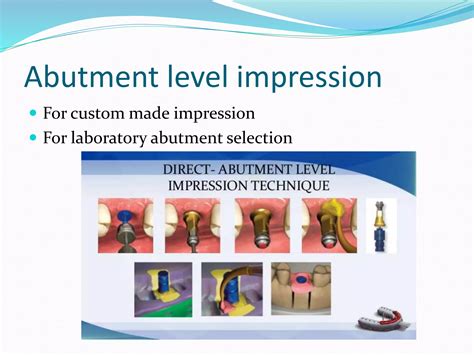 Image result for Impression Procedure